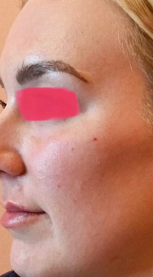 Before & Afters - RN Skn