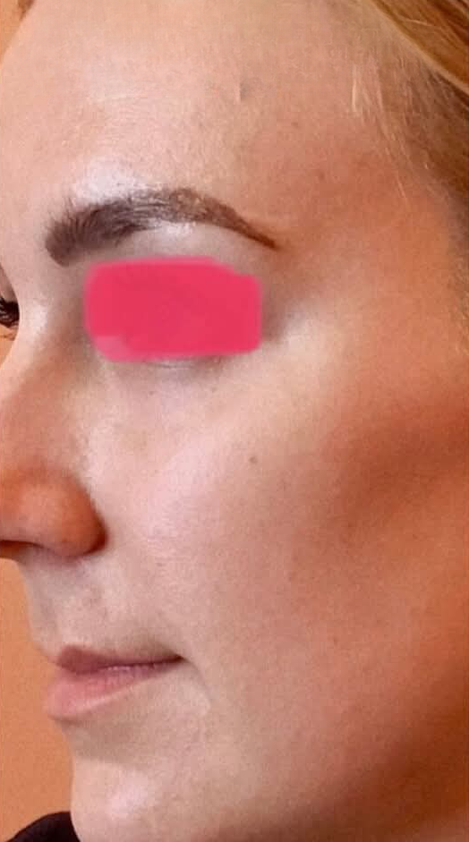 Before & Afters - RN Skn